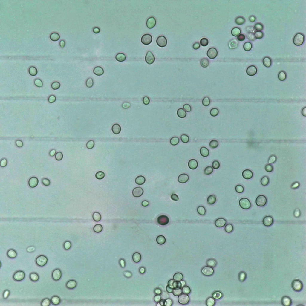 Sample measurement for automatic cell counting with an external camera ...
