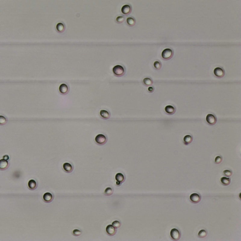 Sample measurement for automatic cell counting with an external camera ...