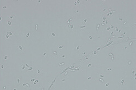 Brettanomyces under Microscope: Manual Analysis vs. Oculyze