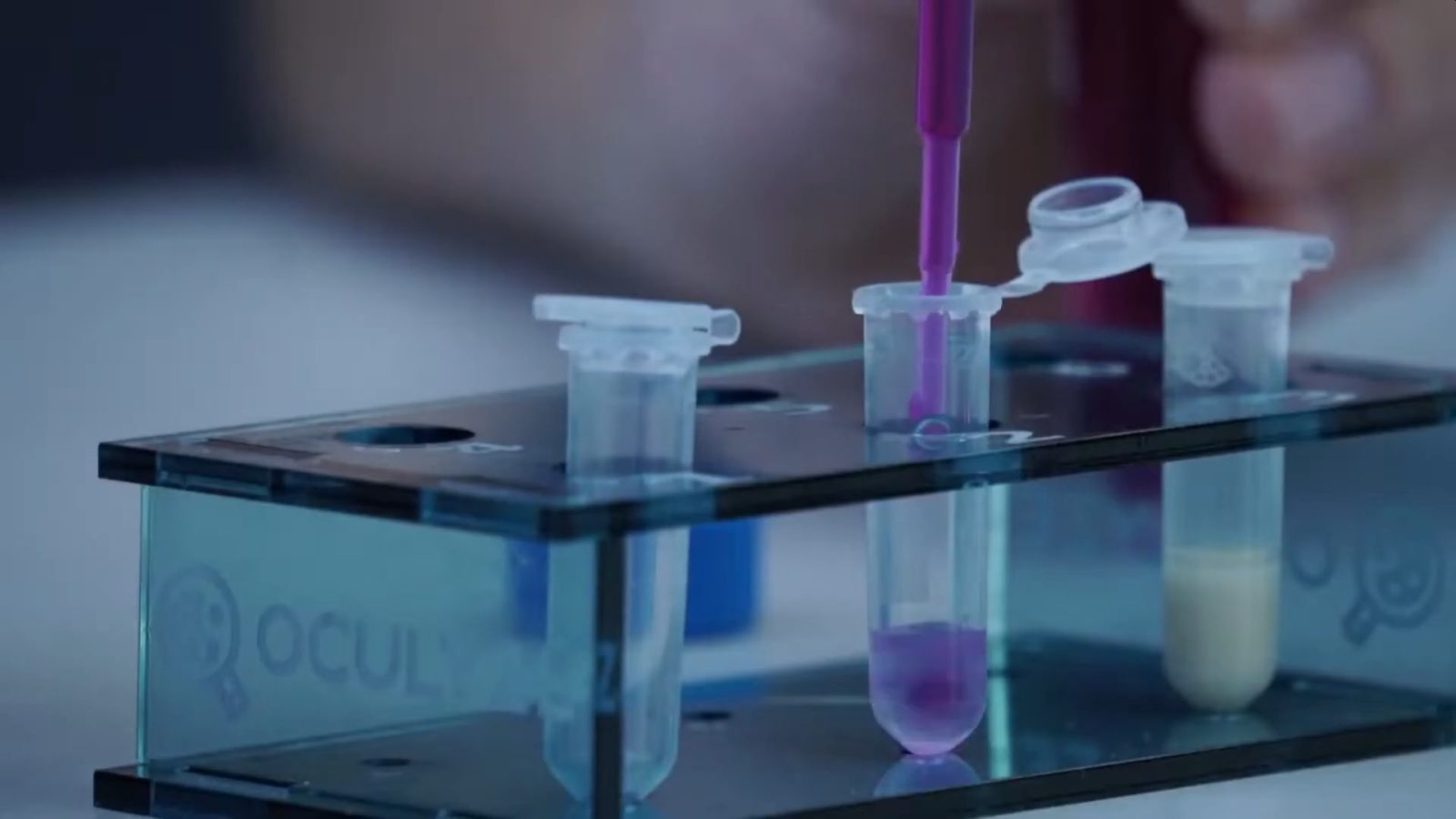 Yeast Staining: Procedure