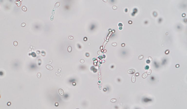 The Counting Yeast Cells Microscope: A Brewer’s Must Have