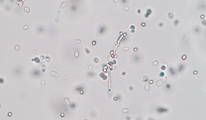 The Counting Yeast Cells Microscope: A Brewer’s Must Have