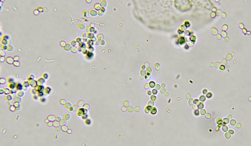 Does Yeast Reproduce by Budding?