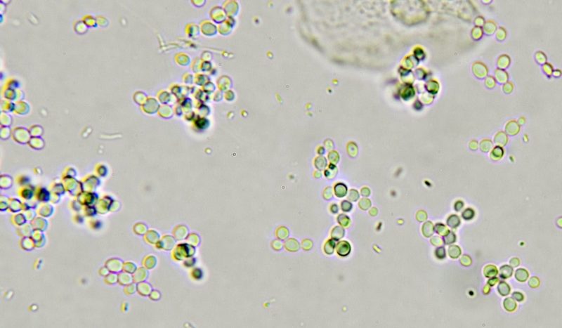 Does Yeast Reproduce By Budding