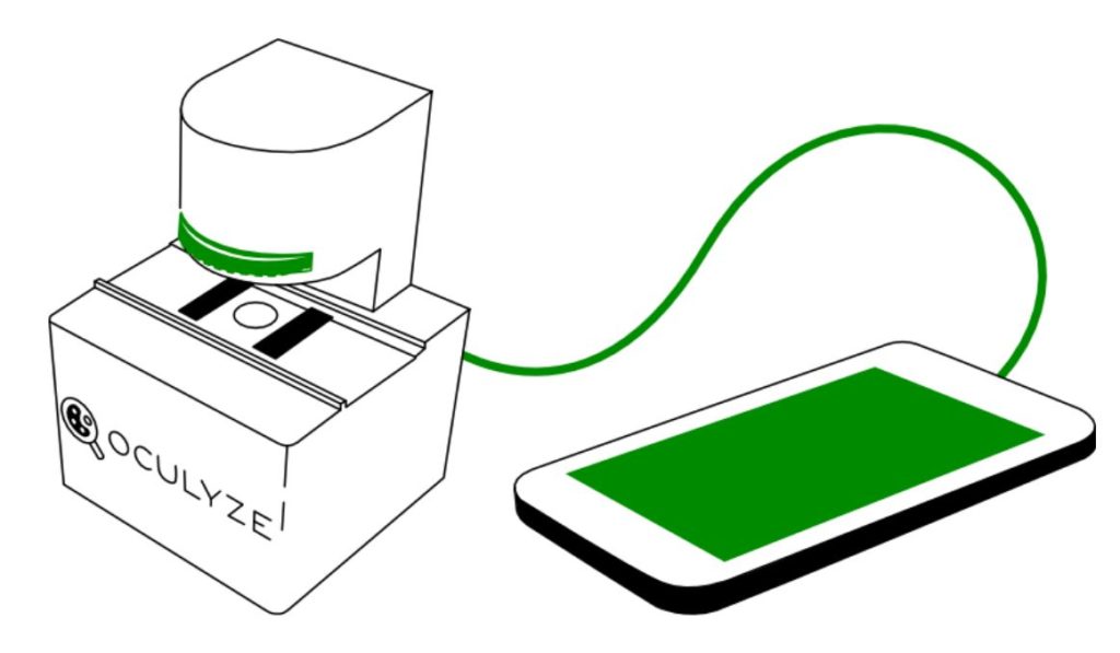 An Adaptable Compact Yeast Monitor: The Advantages