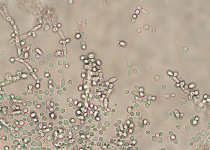 How to Fix Overfed Sourdough Starter