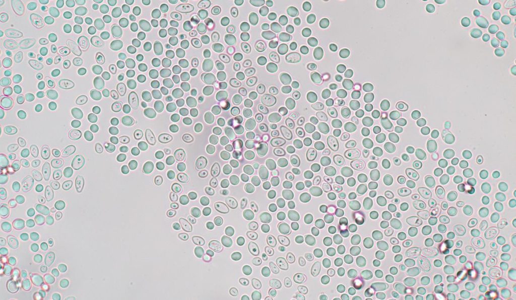 What Does Autolysis Mean and How Can It Affect Beer?