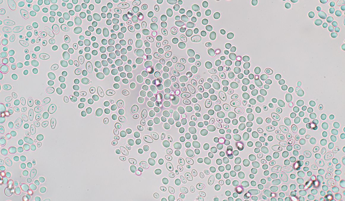What Does Autolysis Mean and How Can It Affect Beer?