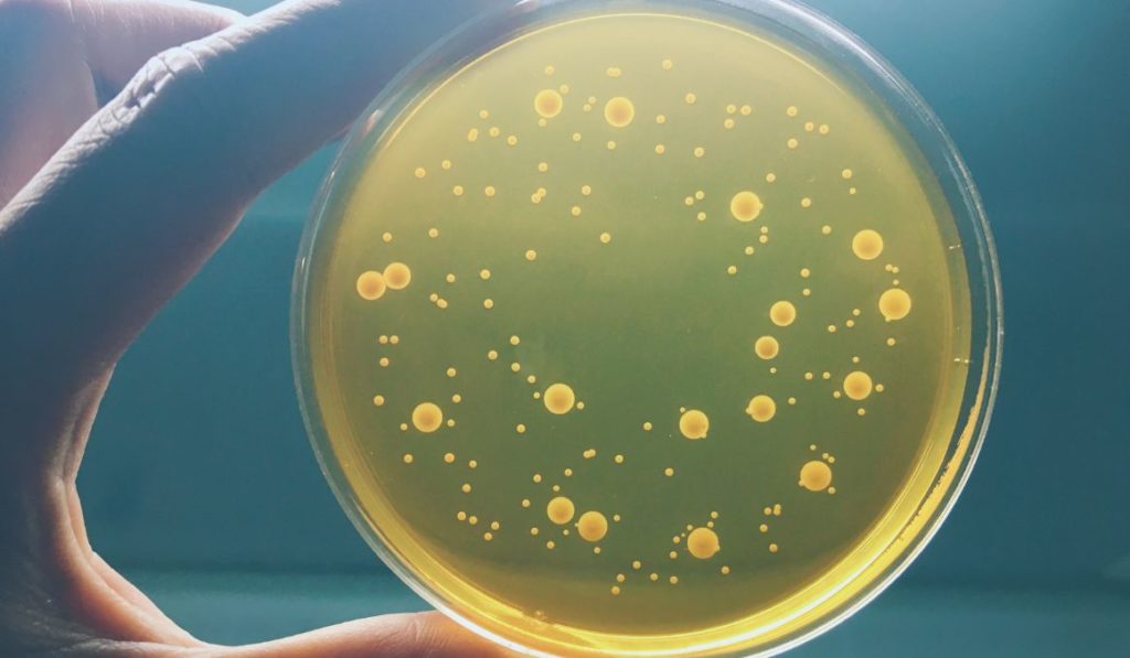 Common Beer Spoilage Bacteria