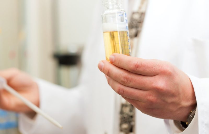 Diastaticus Yeast Infection in Beer