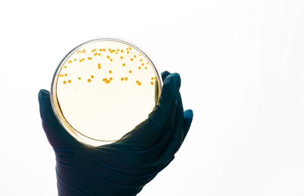 How to Measure Bacteria in a Petri Dish