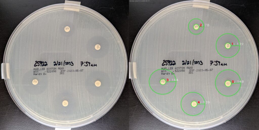How to Measure the Zone of Inhibition: Kirby-Bauer Test