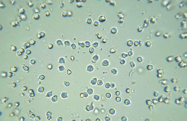 How to Separate Dead Cells from Live Cells in Suspension