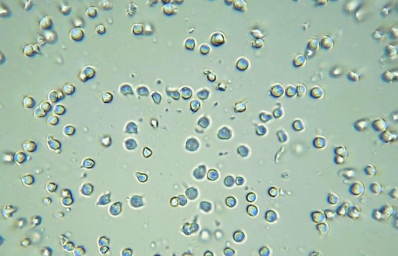 How to Separate Dead Cells from Live Cells in Suspension