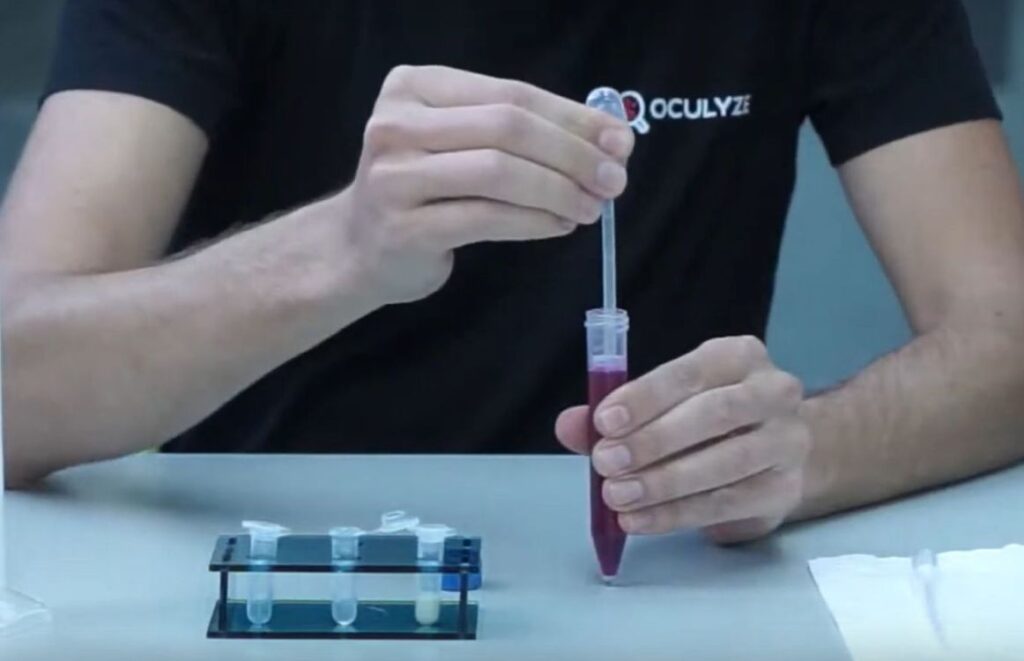 Yeast Cell Count During Fermentation