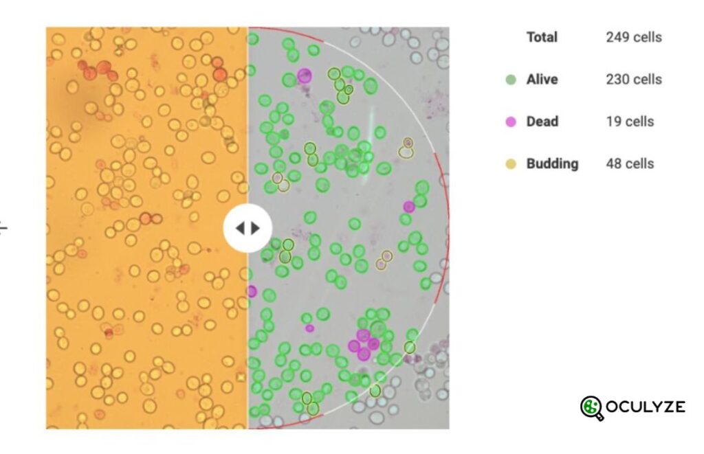 Yeast Cell Count During Fermentation