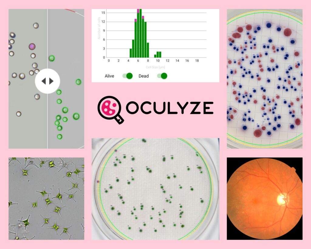 Custom Medical Image Analysis Solutions