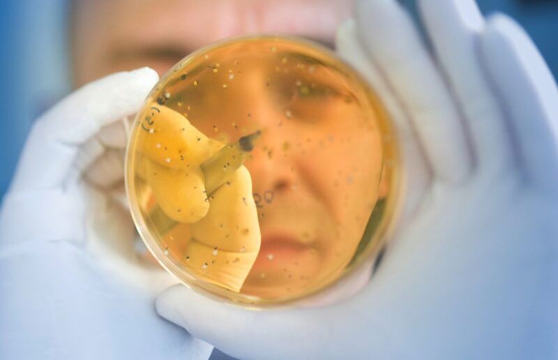 How to Count Bacterial Colonies on Agar Plate