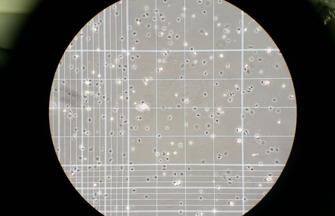 How to Test Yeast Fermentation