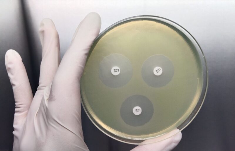 How Is the Zone of Inhibition Measured?