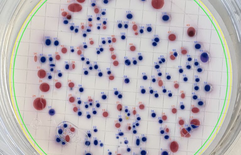 Advantages of Automated Cell Counters