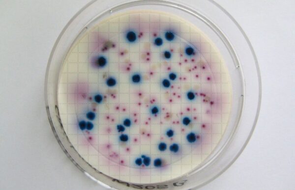 Colony Identifying Bacteria on Agar Plates (pictures in)