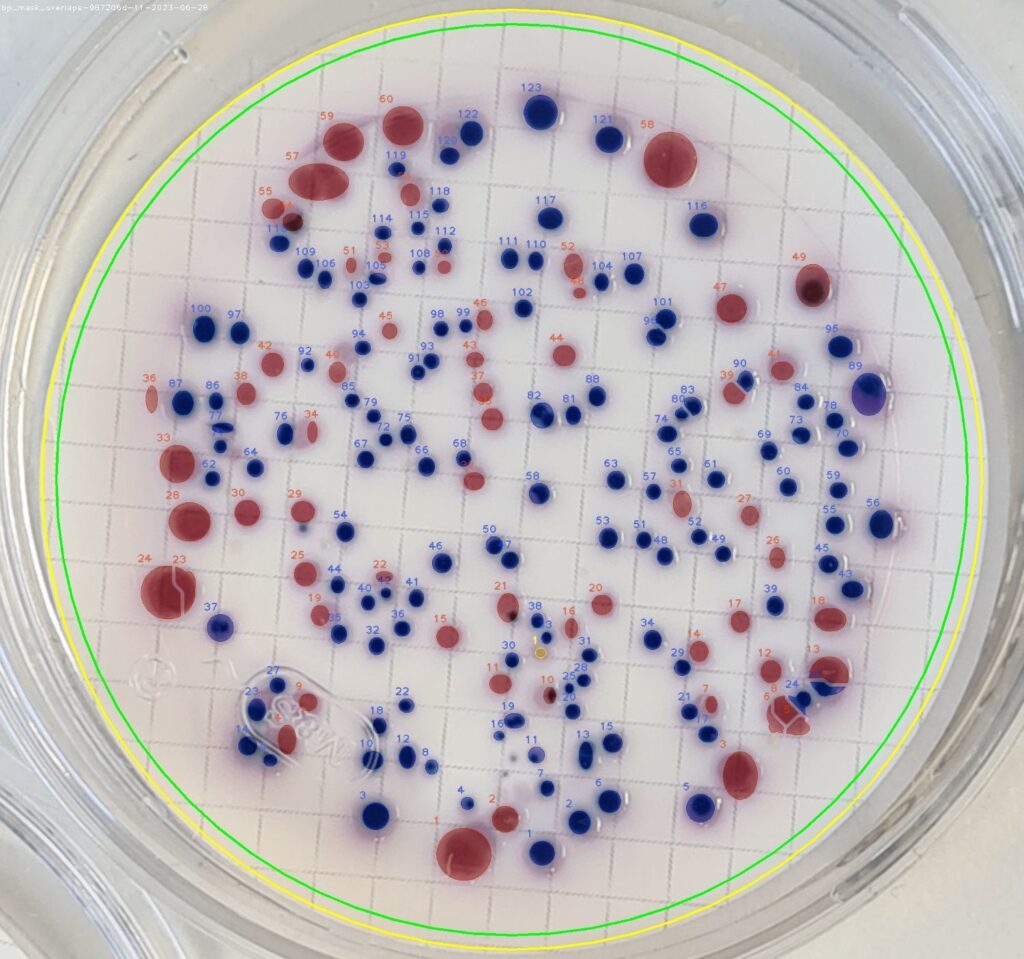 Colony Identifying Bacteria on Agar Plates (pictures in)