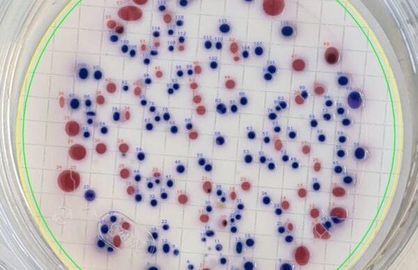 Petri Dish Bacteria Identification Chart: Why Use One