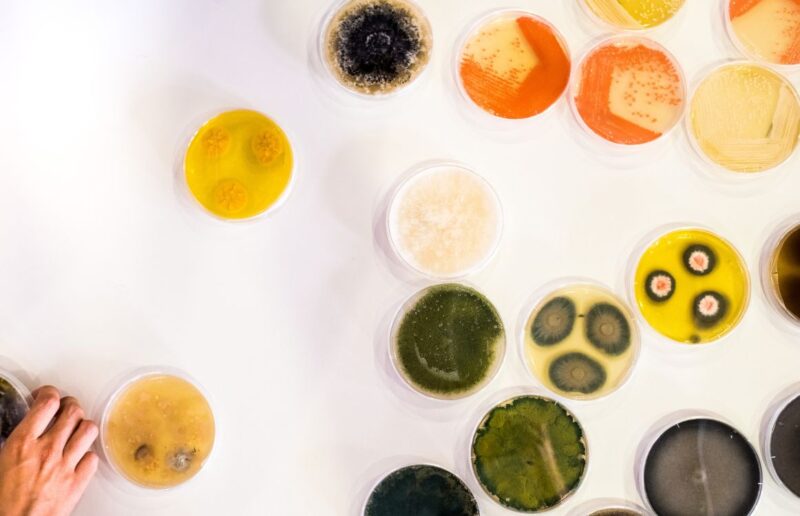 Petri Dish Bacteria Identification Chart: Why Use One